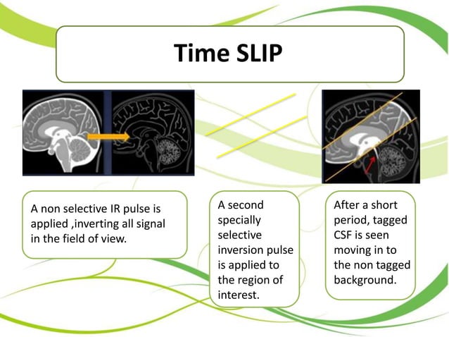 Csf flow study | PPTX