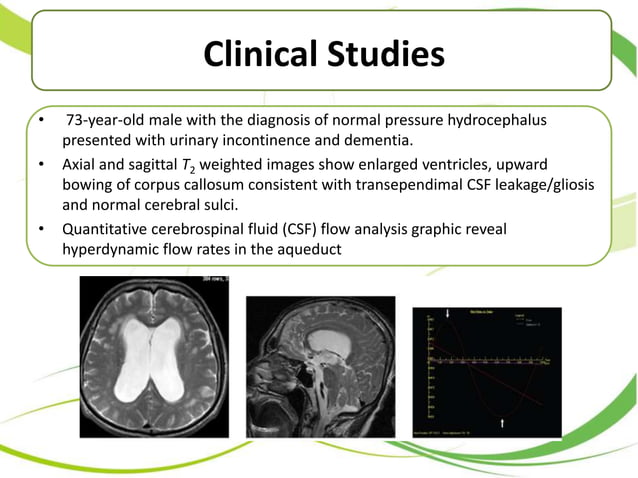 Csf flow study | PPTX