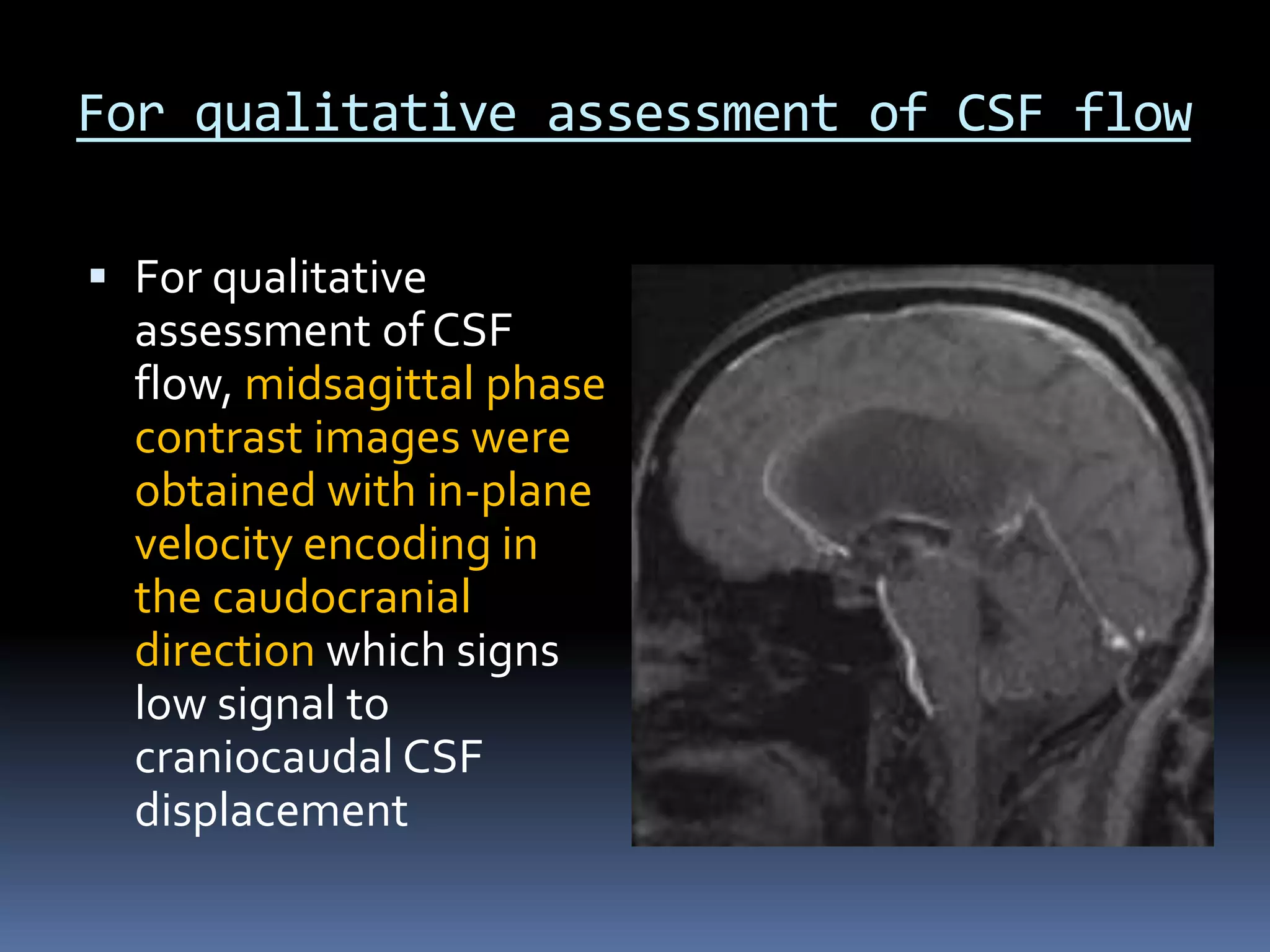 CSF flow study | PPTX