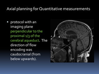 CSF flow study | PPT