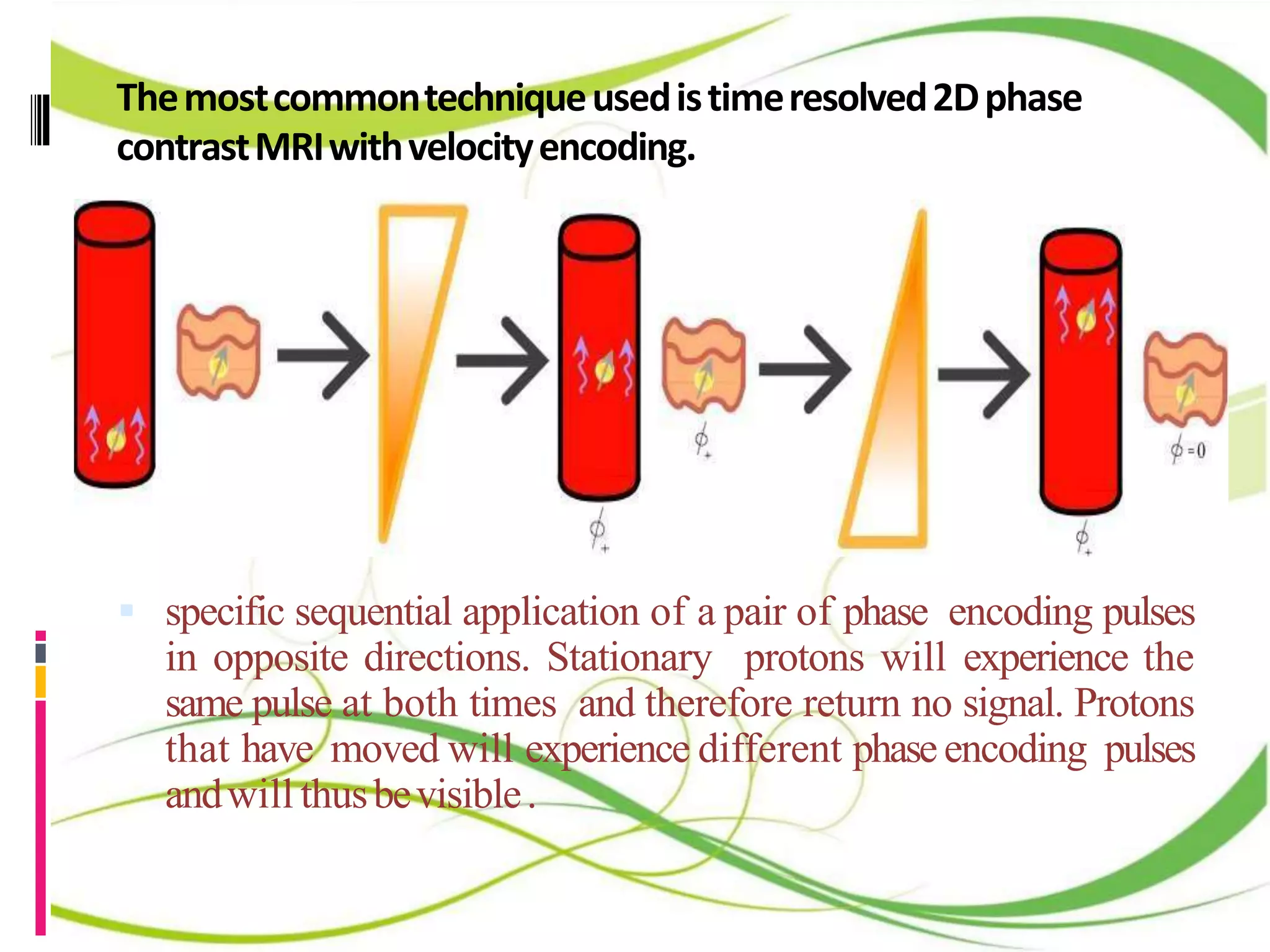CSF Flow Study In MRI | PPTX