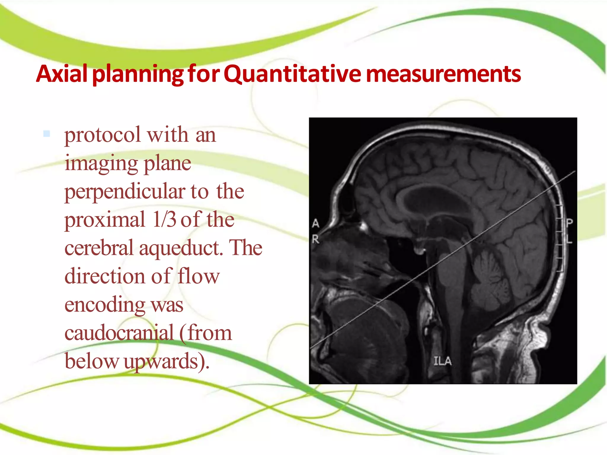 CSF Flow Study In MRI | PPTX