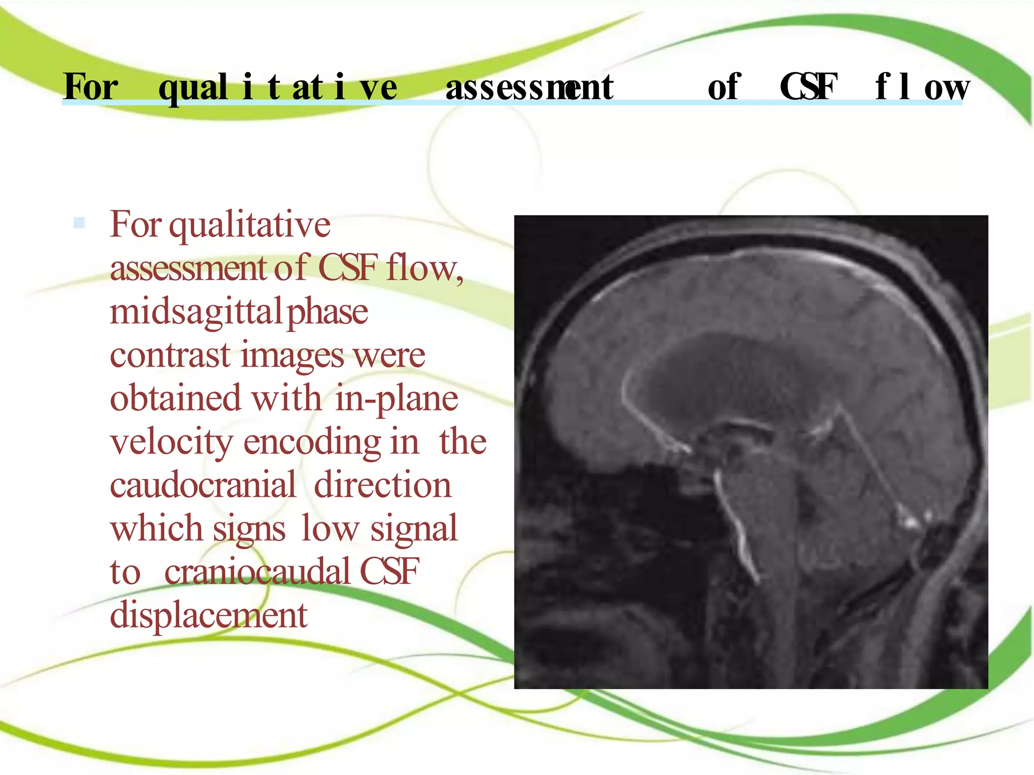 CSF Flow Study In MRI | PPTX