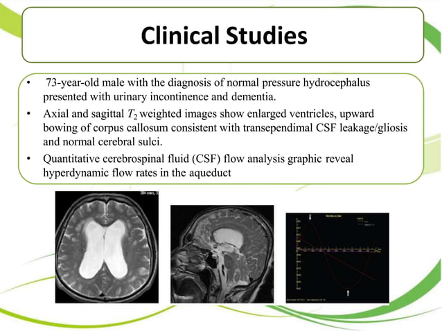 CSF Flow Study In MRI