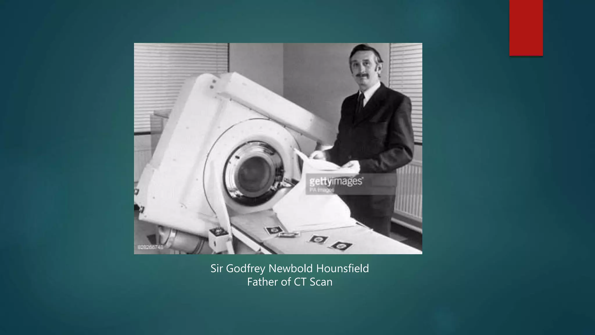 Csf Rhinorrhea - Overview | PPTX