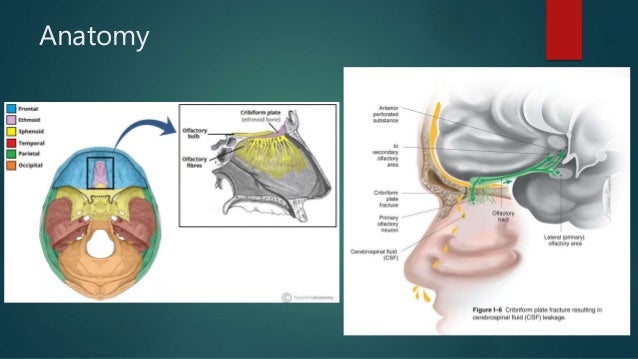 Csf Rhinorrhea - Overview