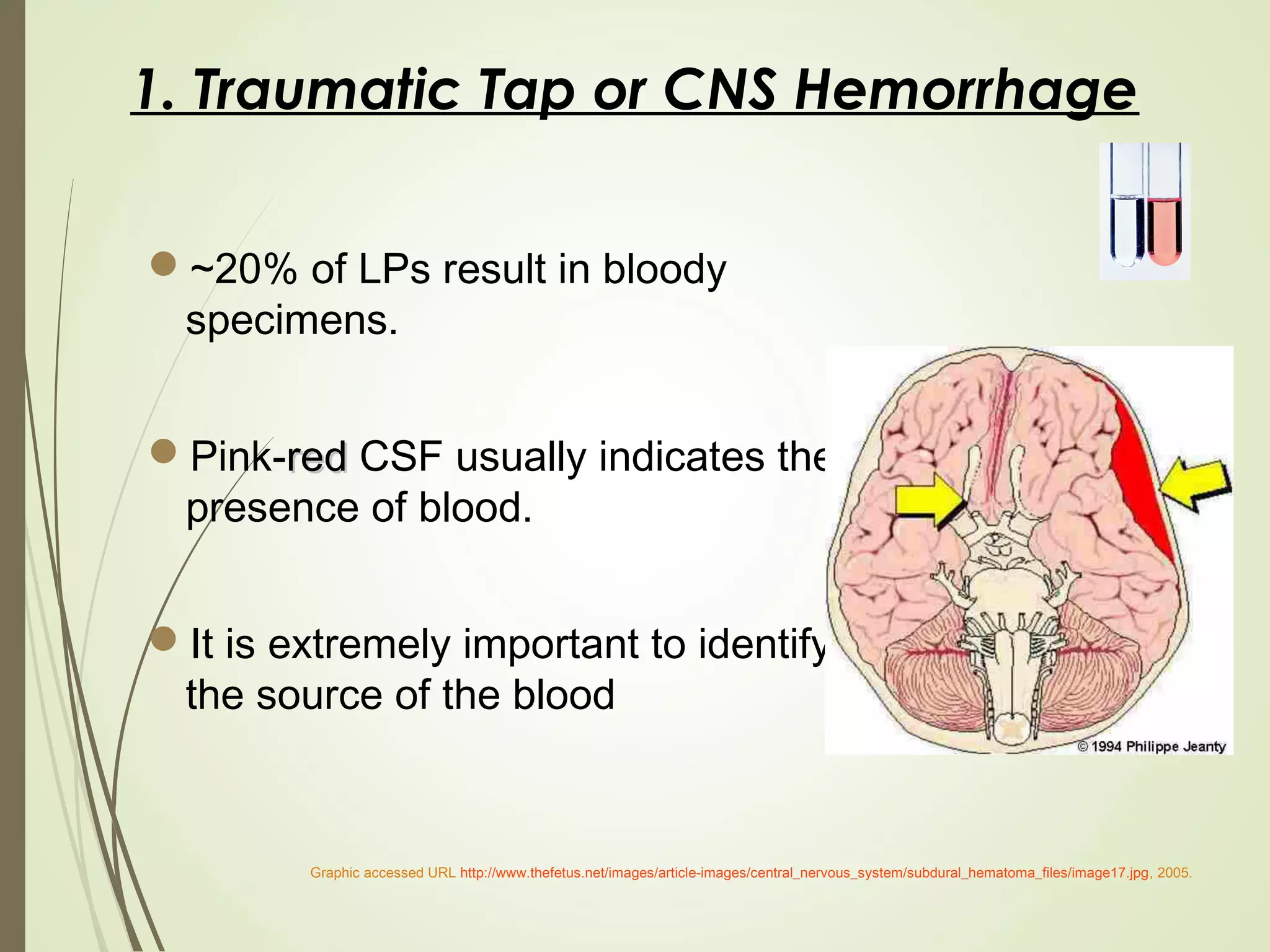 CSF Examination | PPT