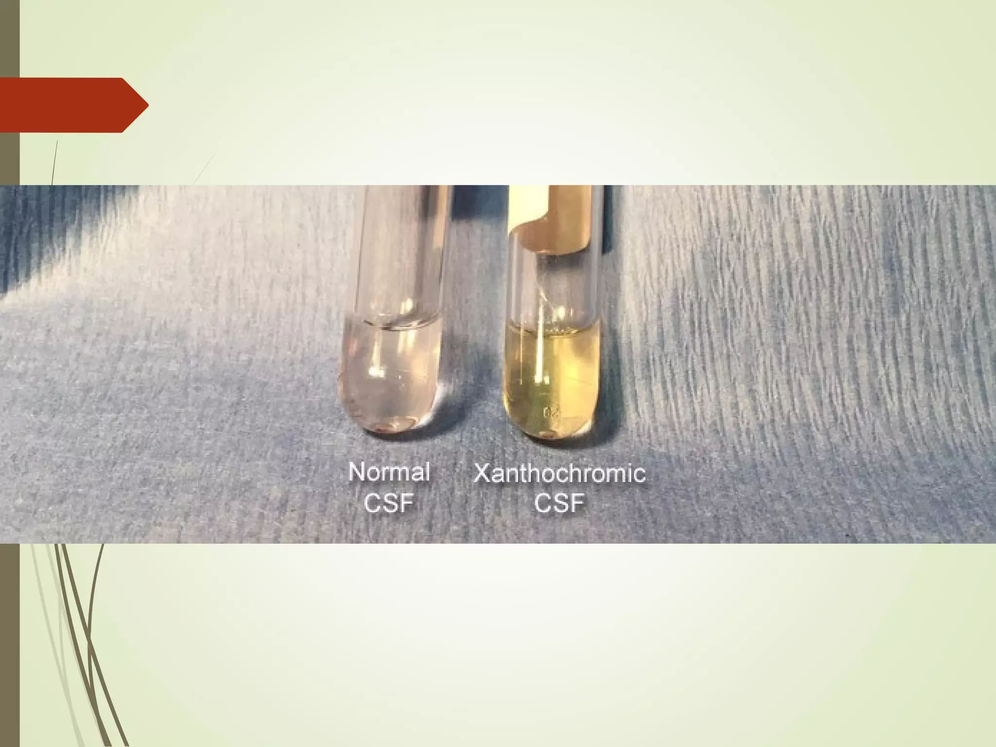 CSF Examination | PPT