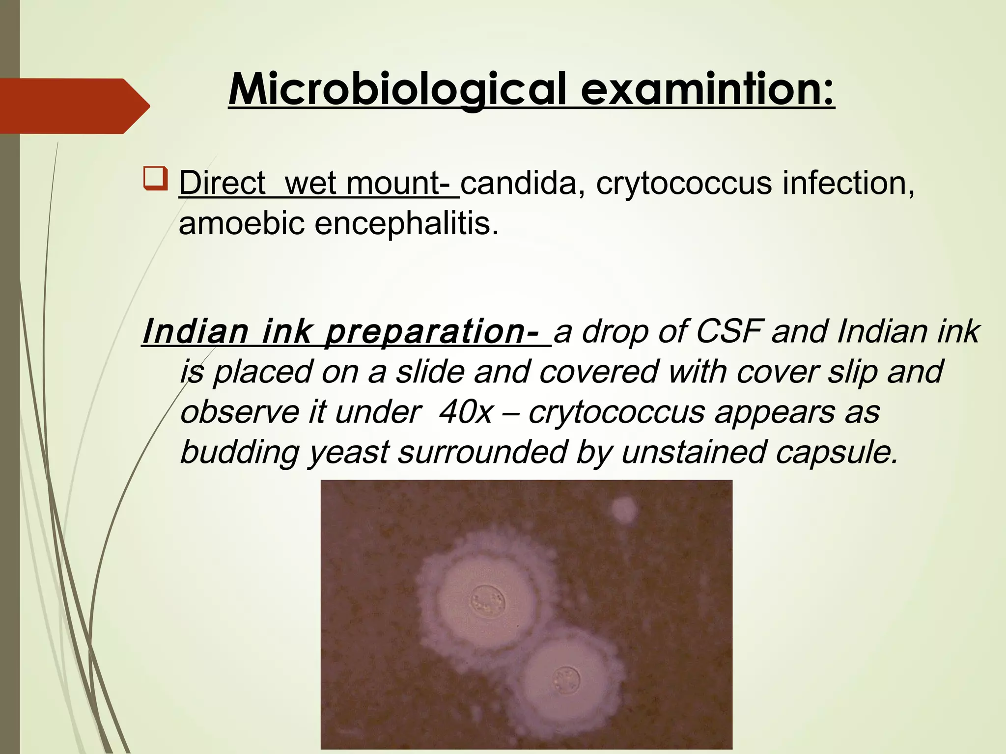 CSF Examination | PPT