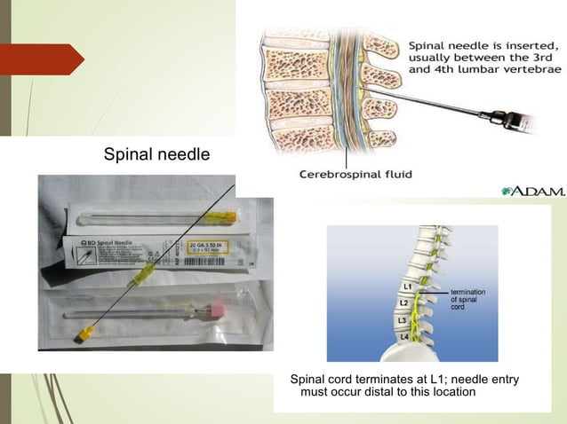 CSF Examination | PPT | Blood Disorders | Diseases and Conditions