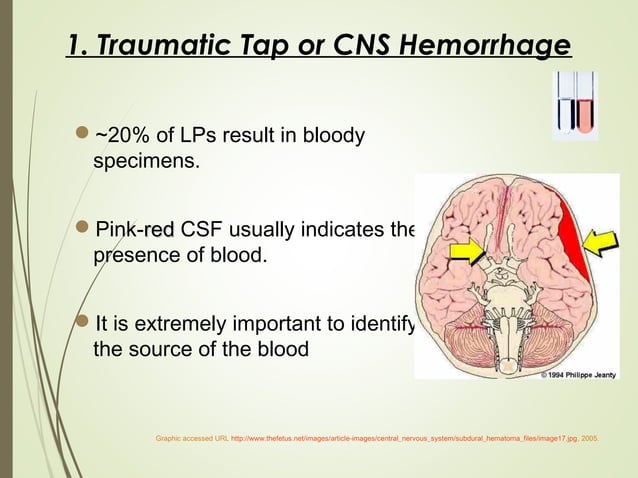 CSF Examination | PPT | Blood Disorders | Diseases and Conditions