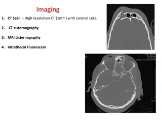 Csf leak and antibiotic. | PPTX | First Aid | Injuries