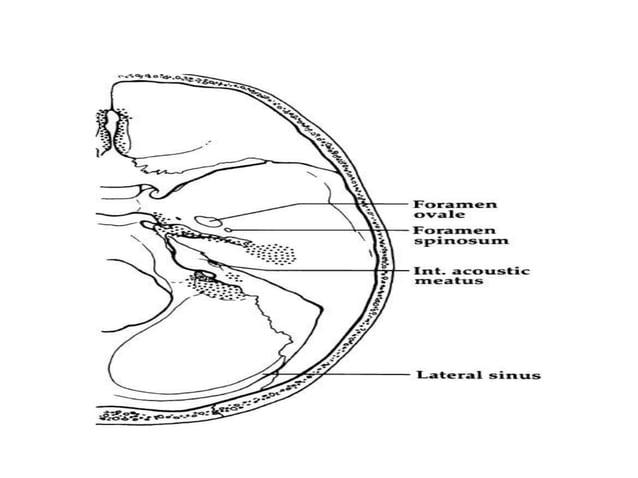 Csf oto.pptx1 | PPTX | Ear, Nose and Throat Conditions | Diseases and ...