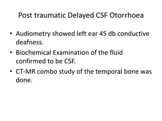 Csf otorrhoea | PPTX