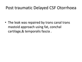 Csf otorrhoea | PPTX