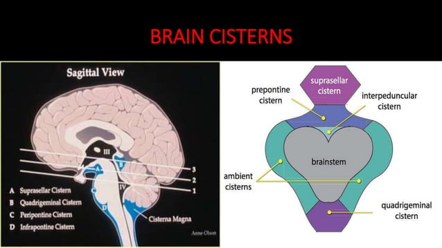 Csf pathway and hydrocephalus | PPTX | Brain and Nervous System ...