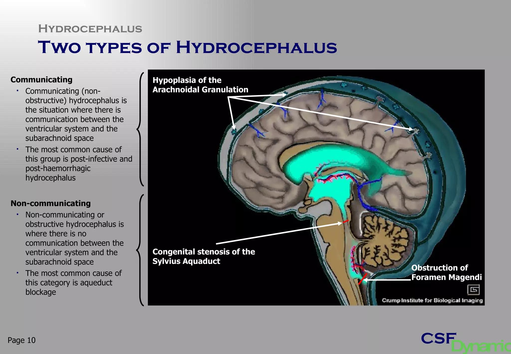 Csf Presentation 2009 | PPT