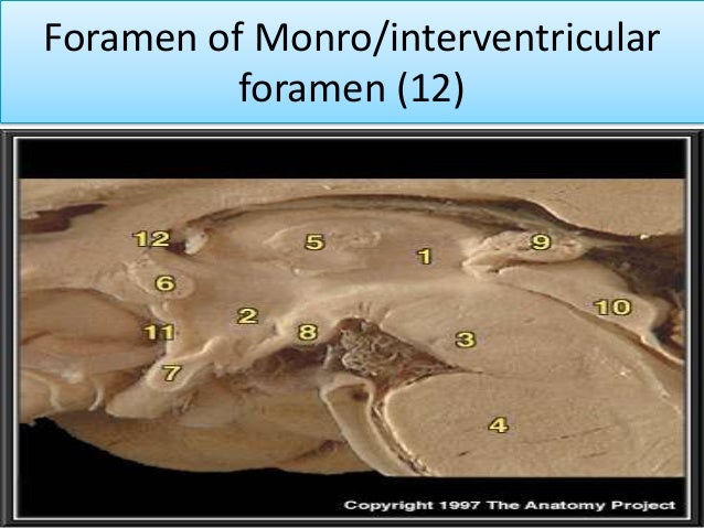 Csf production,circulation & absorption