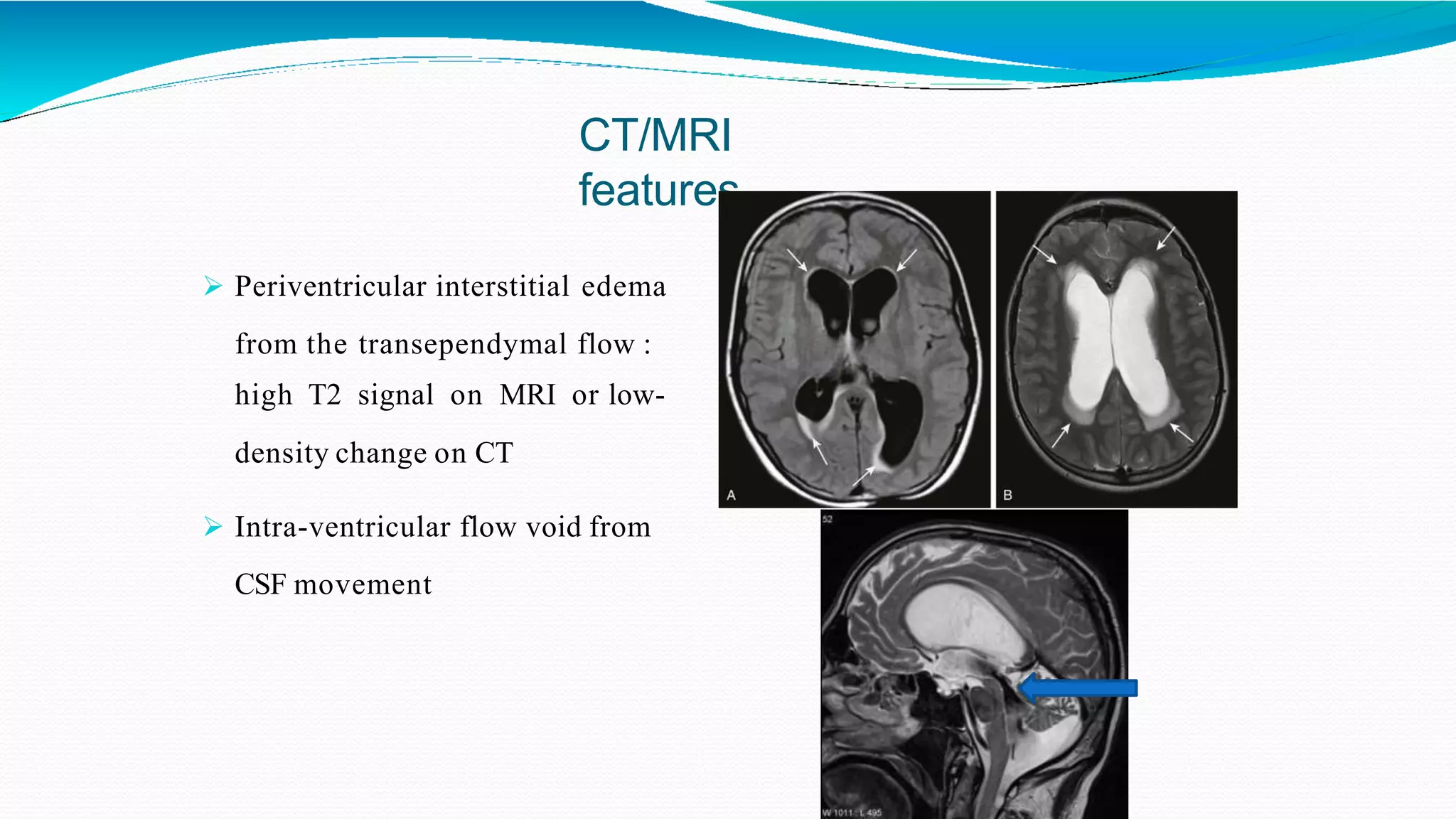 CSF Production, Dynamics and Physiology | PPTX
