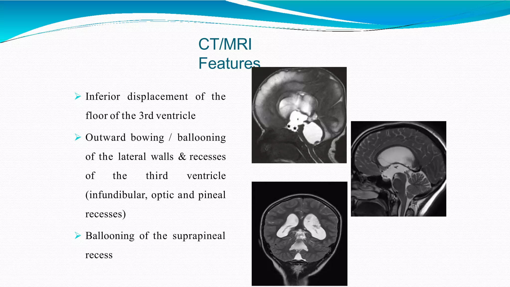 CSF Production, Dynamics and Physiology | PPTX