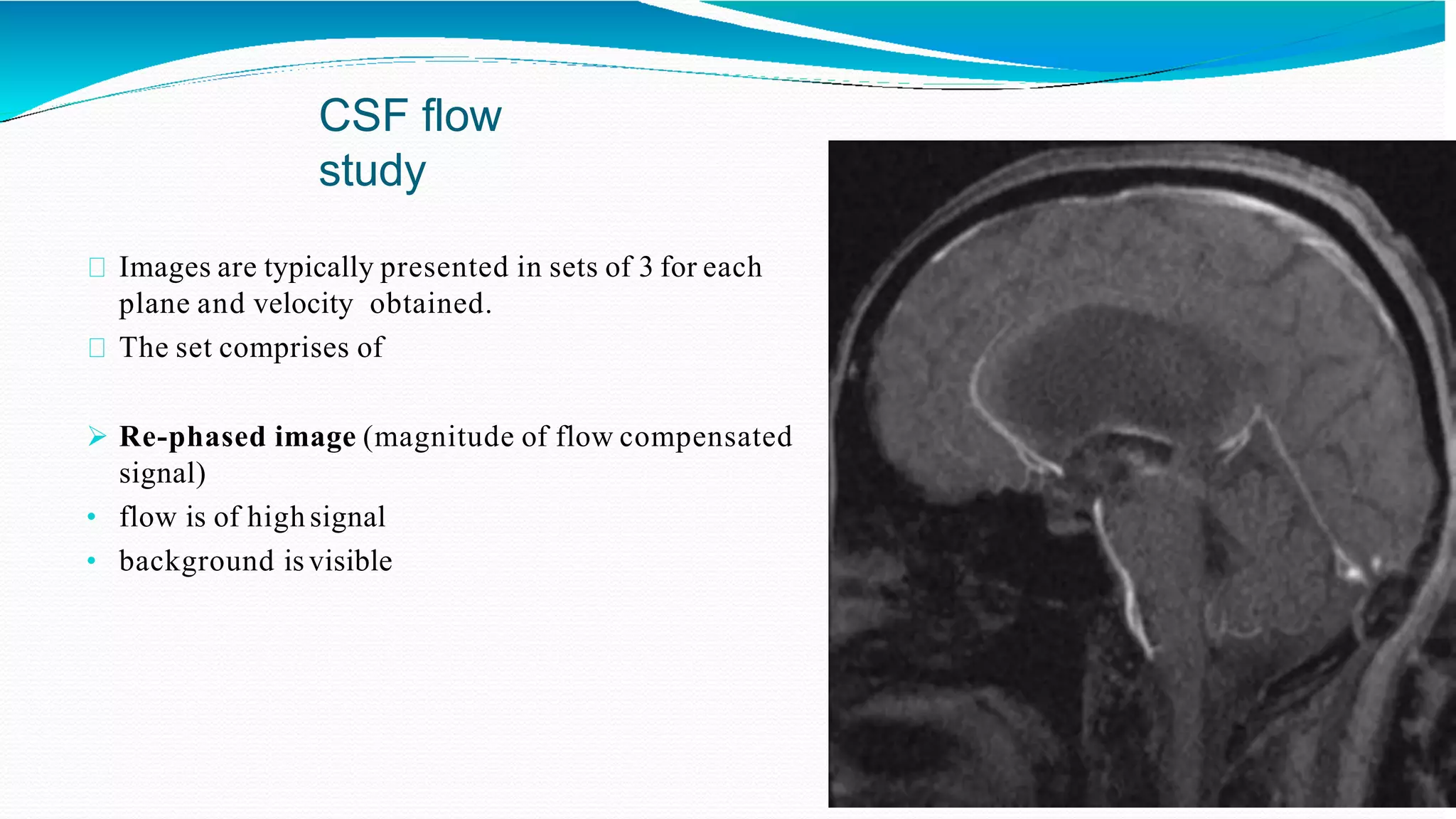 CSF Production, Dynamics and Physiology | PPTX
