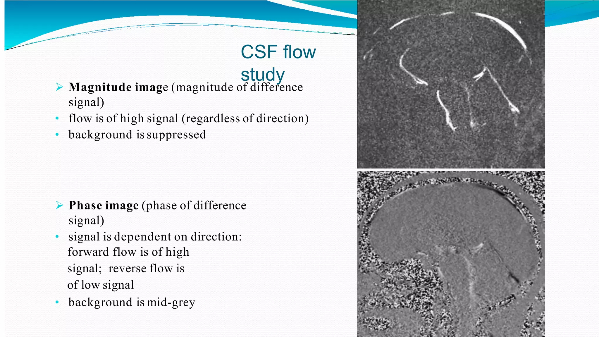 CSF Production, Dynamics and Physiology | PPTX
