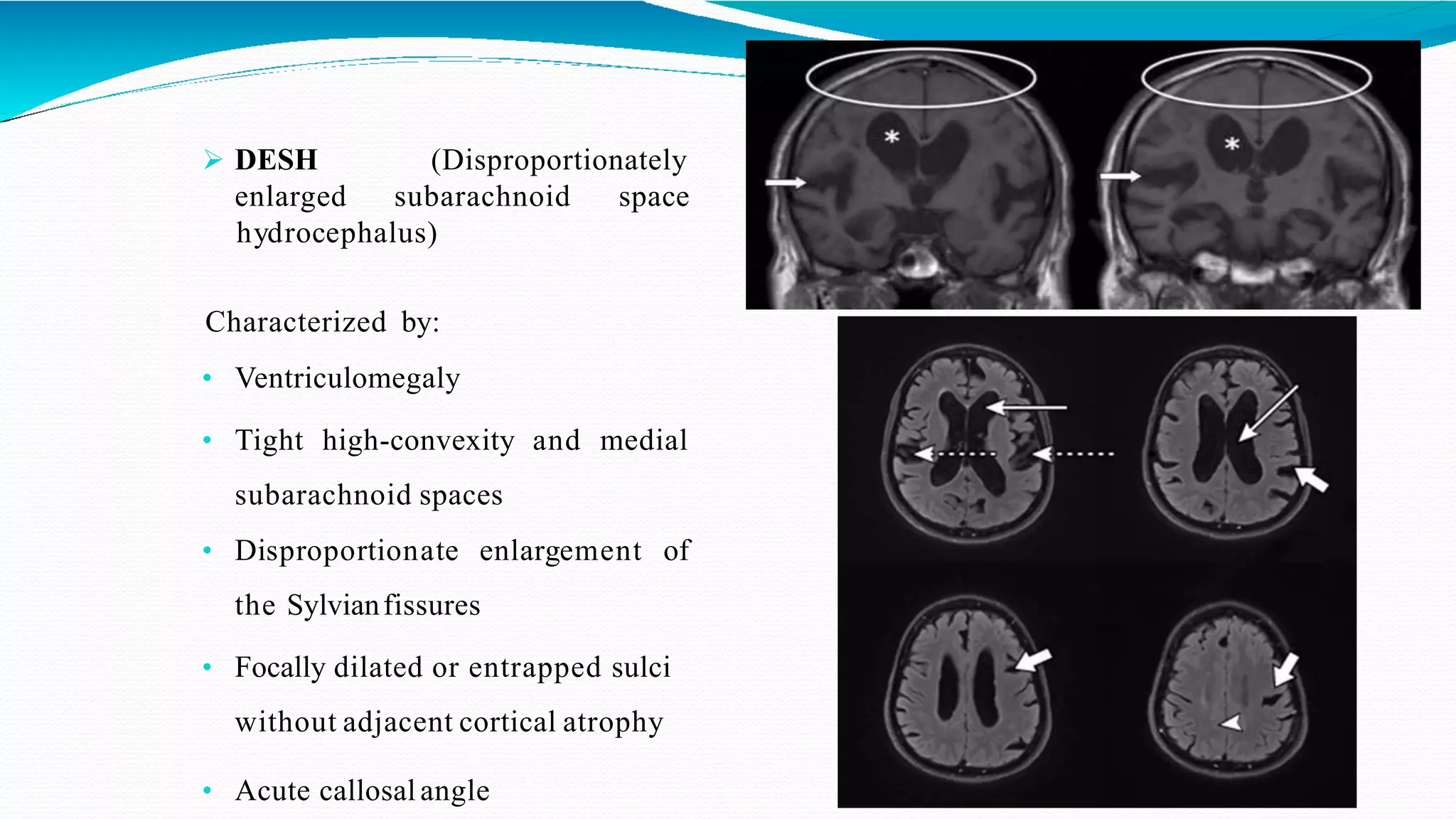 CSF Production, Dynamics and Physiology | PPTX