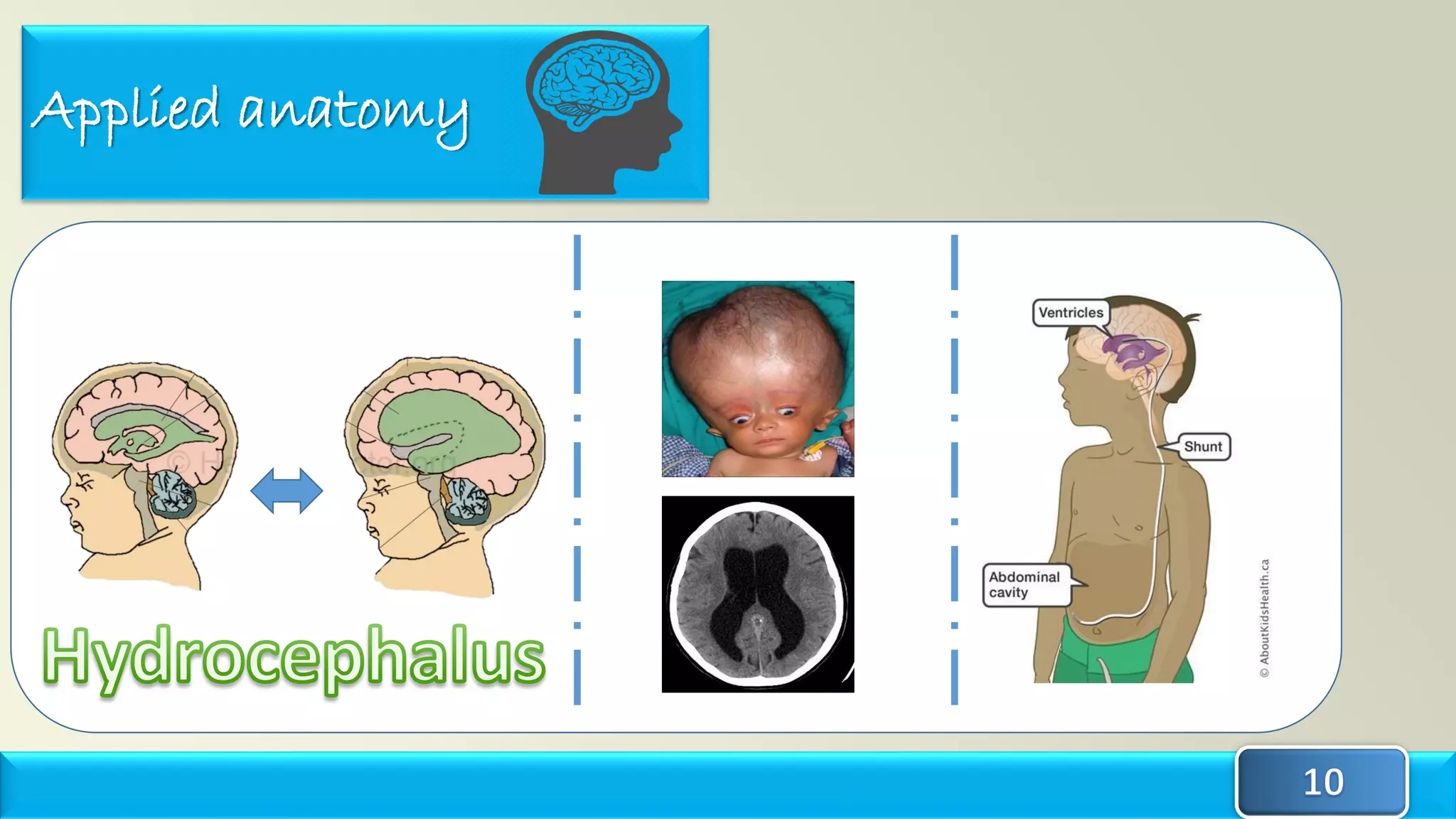 Cerebrospinal Fluid Csf Production Circulation And Absorption Ppt