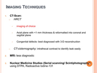 CSF Rhinorrhea | PPTX
