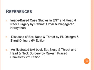 CSF Rhinorrhea | PPTX