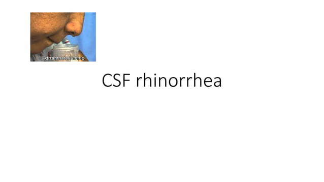 Csf rhinorrhea ppt | PPTX | Ear, Nose and Throat Conditions | Diseases ...