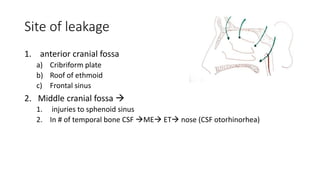 Csf rhinorrhea ppt | PPTX