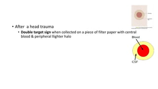 Csf rhinorrhea ppt | PPTX | Ear, Nose and Throat Conditions | Diseases ...