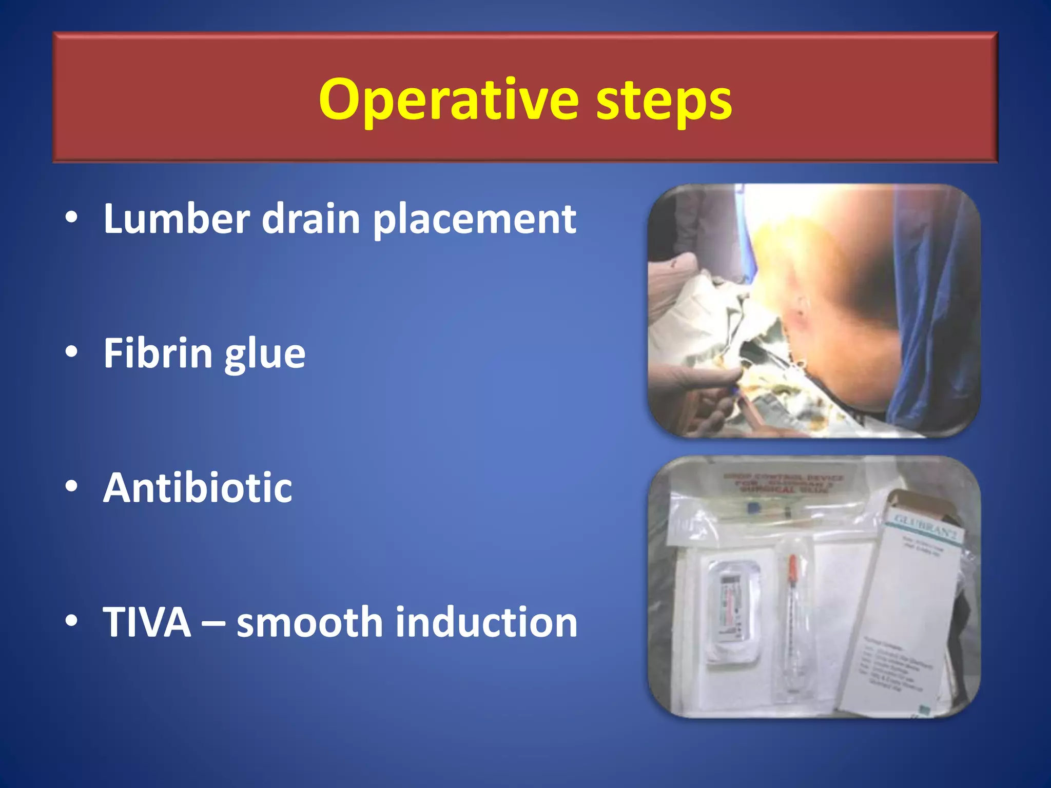Csf rhinorrhea repair- case report and discussion | PPTX