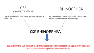 CSF Rhinorrhea | PPTX