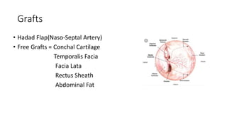 CSF Rhinorrhea | PPTX | Ear, Nose and Throat Conditions | Diseases and ...