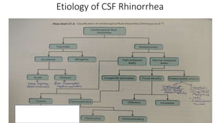 CSF Rhinorrhea | PPTX