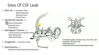 CSF Rhinorrhea | PPTX
