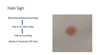 CSF Rhinorrhea | PPT