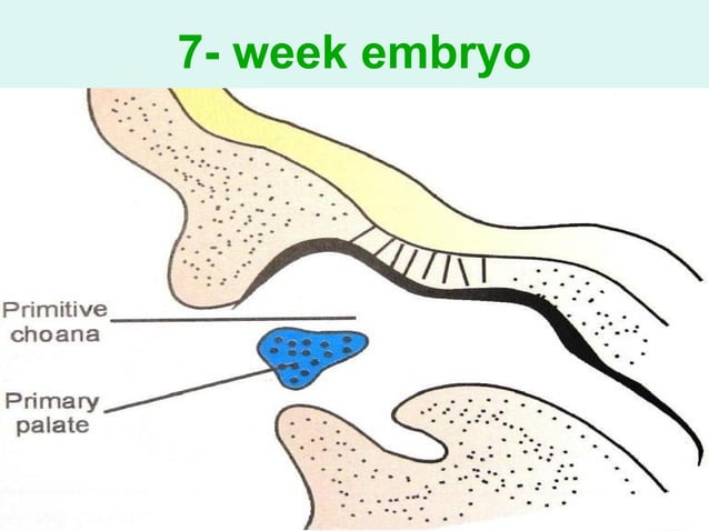 CSF rhinorrhea, choanal atresia, Septal hematoma, abscess .pptx