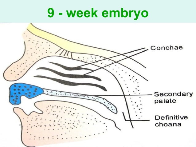 CSF rhinorrhea, choanal atresia, Septal hematoma, abscess .pptx