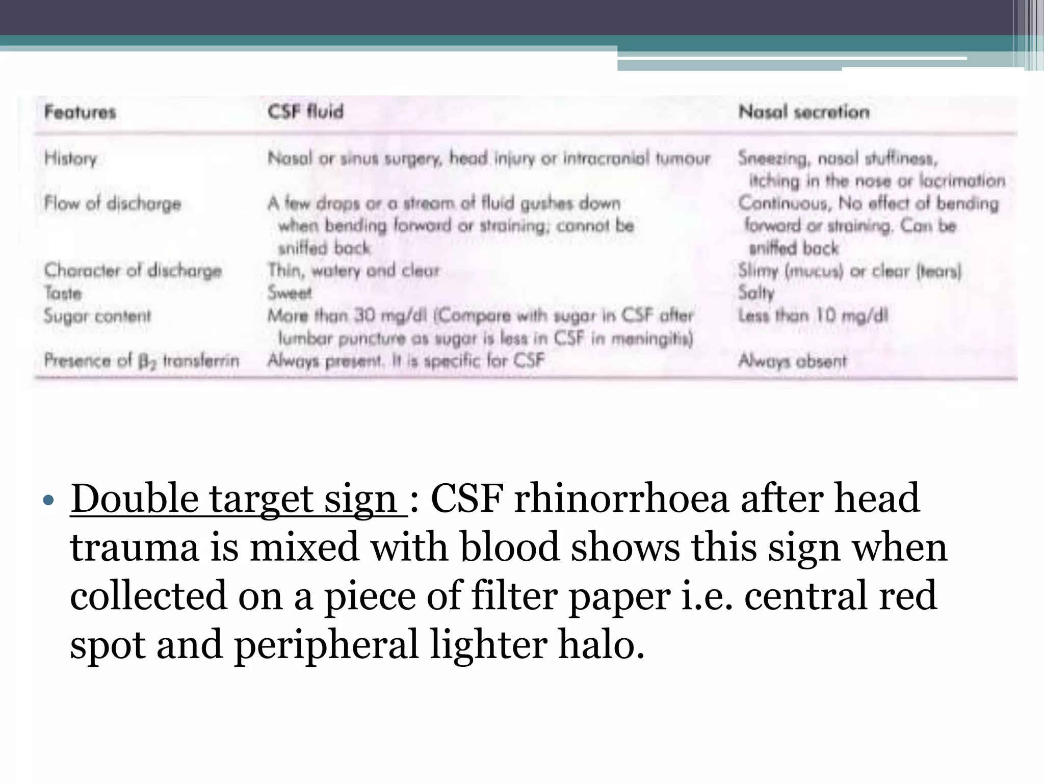 Csf rhinorrhoea | PPTX