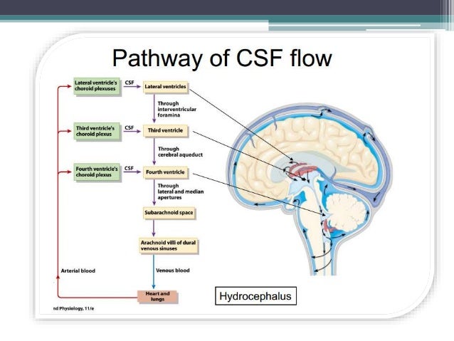 Csf rhinorrhoea