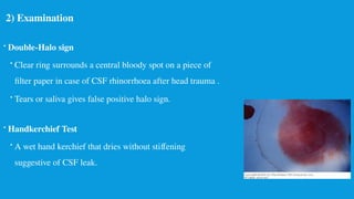 Cerebrospinal fluid rhinorrhoea. Pptx 1 | PPTX