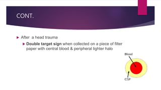 Csf rhinorrhoea | PPTX