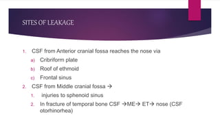 Csf rhinorrhoea | PPTX