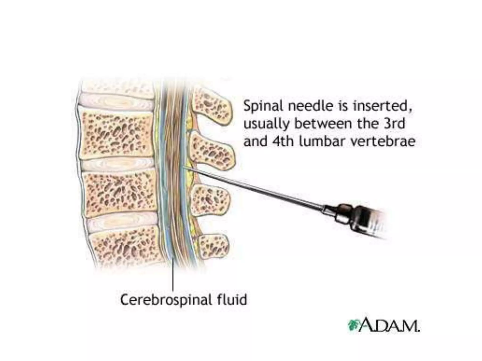 Fluid cytology in CSF | PPSX