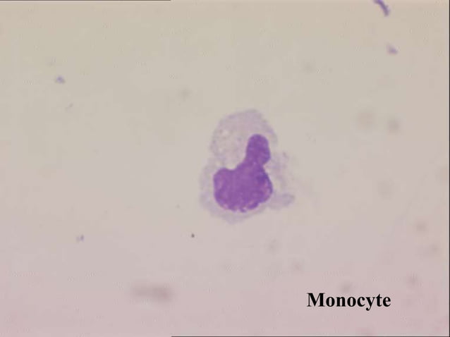 Fluid cytology in CSF | PPSX