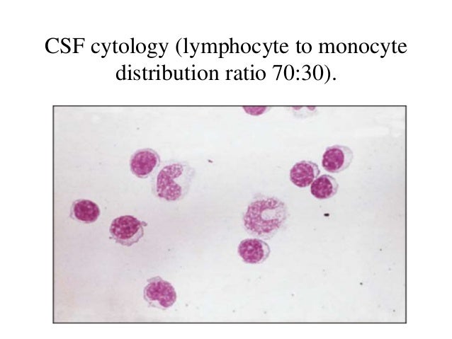 Fluid cytology in CSF