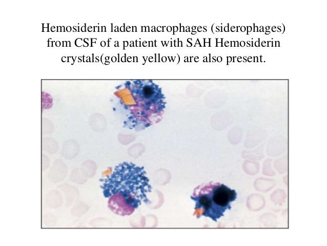Fluid cytology in CSF